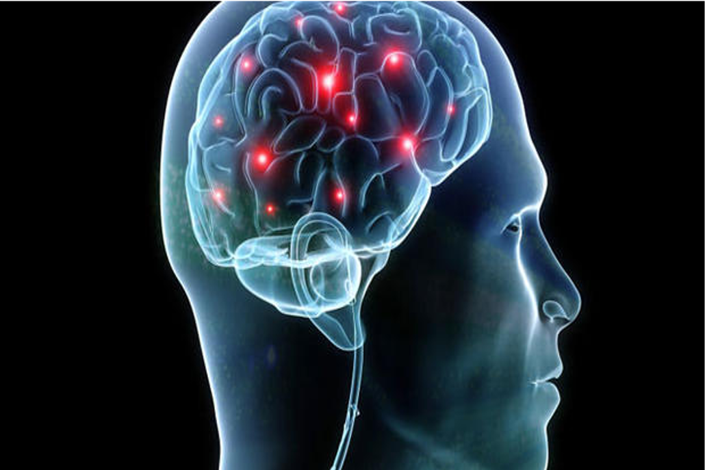 Cosa è il Neuro-Training - Messaggerie Sarde